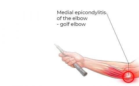 TendoMax | Vemax Pharma